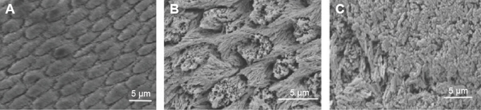 Prevention. Illuminated. - CALCIVIS®