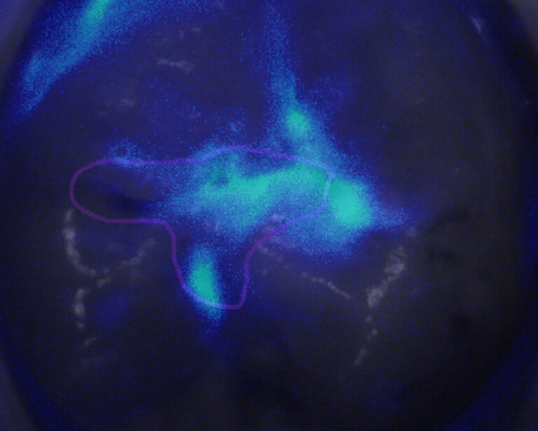 Prevention. Illuminated. - CALCIVIS®