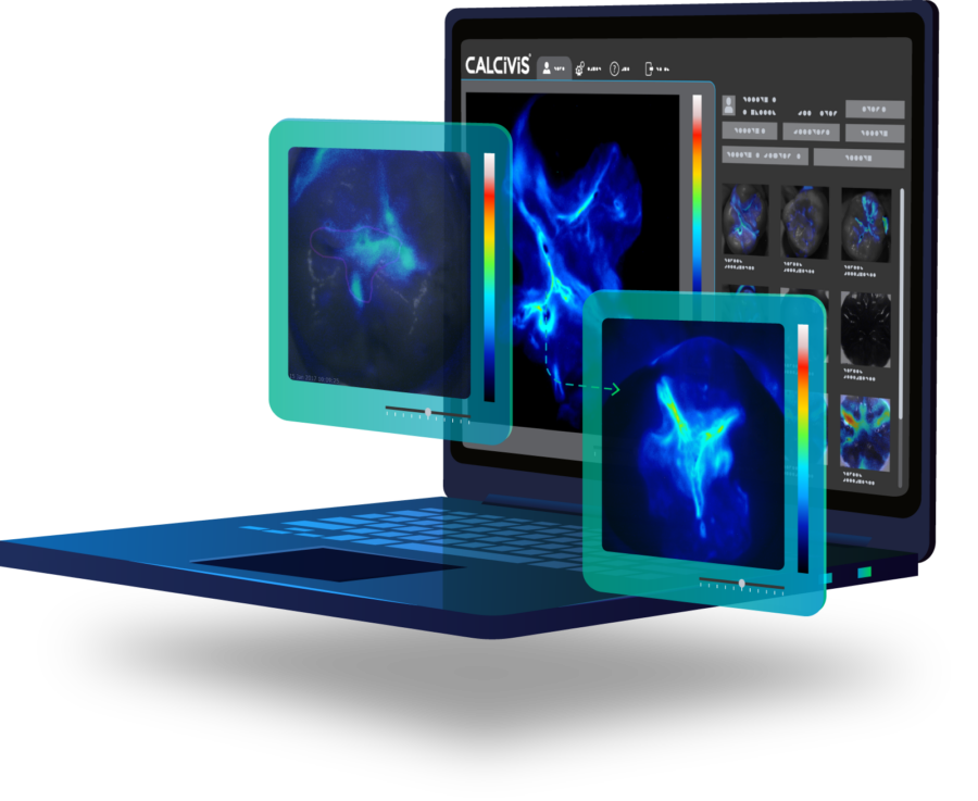 Downloads - CALCIVIS®